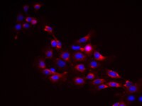MOC2 Mouse Oral Squamous Cell Carcinoma (OSCC) Cell Line | SCC470